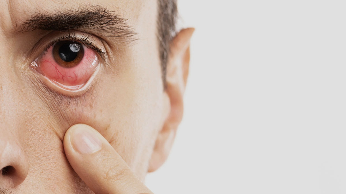 Common Retinal Diseases and How to Treat Them